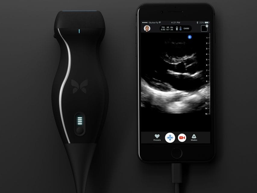 New Revolutionize Tool Lets a doctor Ultrasound with Smartphone Gadget