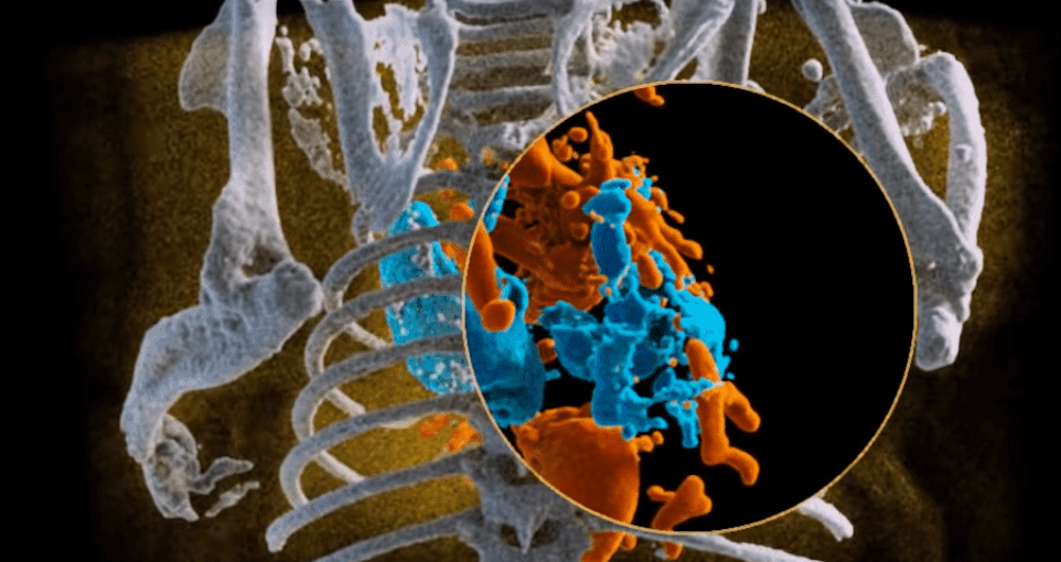 World’s First Full Color 3D X-Rays Technology To See Human Body